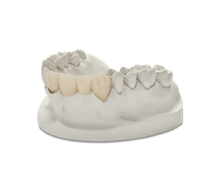 Full-Service Dental Lab | Dental Lab Services | DDS Lab