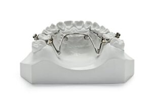 Orthodontics Lab - Quad-Helix Arch Development | DDS Lab