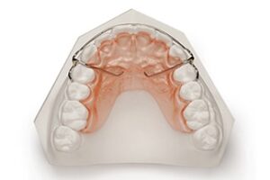 Orthodontics Laboratory - Retainer and Finishing | DDS Lab
