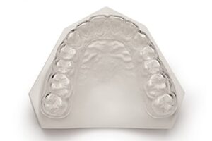 Orthodontics Laboratory - Retainer and Finishing | DDS Lab