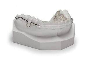 Orthodontics Laboratory - Retainer and Finishing | DDS Lab