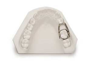 Space Maintainers, Regainers, and Bite Plates | DDS Dental Lab