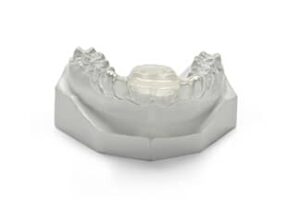 Deprogrammer Mouthguard | Dental Deprogrammer | DDS Lab