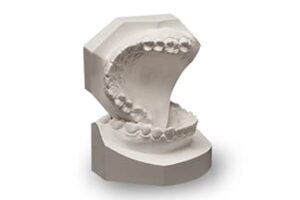 Orthodontic Lab | Orthodontic Dental Lab | DDS Lab