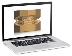 Digital Dental Models | Dental Model Storage | DDS Lab