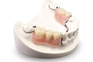 Denture Lab | Removable Dentures | DDS Lab